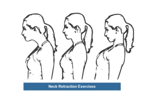 Neck Exercises to Reduce Pain | Reinhardt Chiropractic