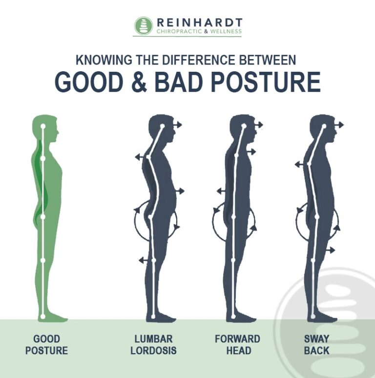Can a Chiropractor Help With Posture? | Reinhardt Chiropractic